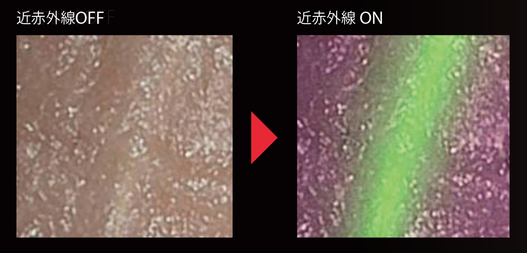 NIRC™ 蛍光尿道カテーテル | カーディナルヘルス医療関係者向け製品情報サイト