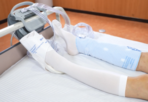 DVT/VTEの理学的予防法（間欠的空気圧迫装置・弾性ストッキング） | カーディナルヘルス医療関係者向け製品情報サイト